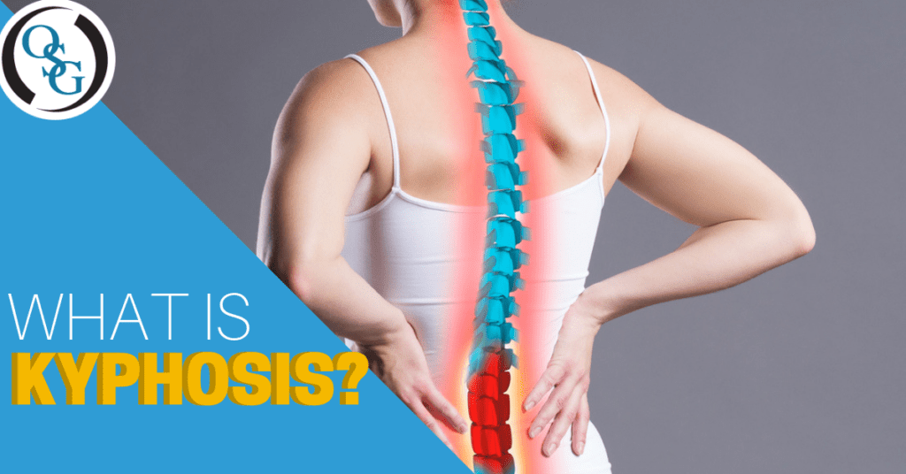 What Is Kyphosis? | Orthopedic Doctor Fairfield County